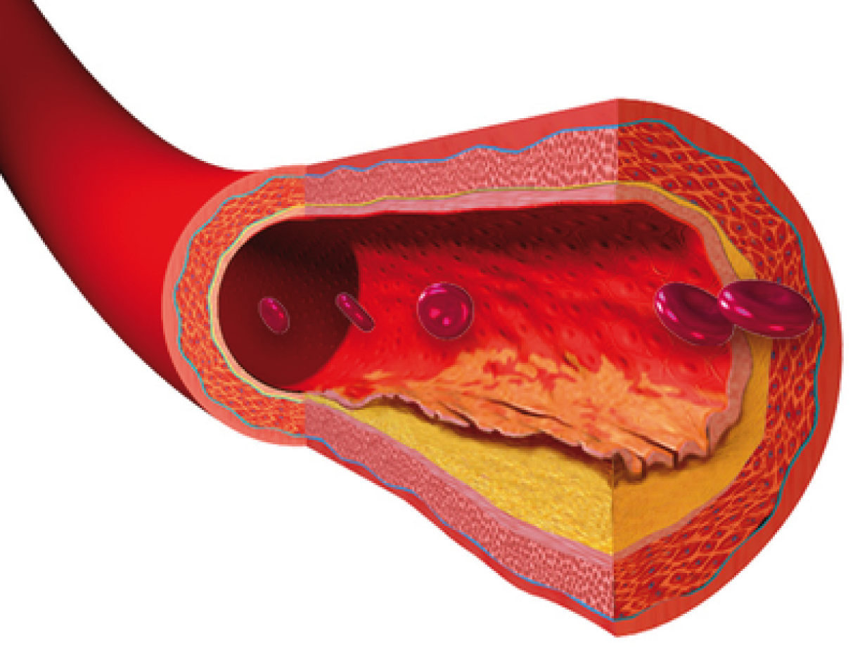 Blutkreislauf - Physiologie - Bio - Digitales Schulbuch - Skripte ...